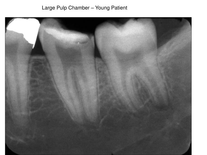 PPT - RADIOGRAPHIC INTERPRETATION OF PULPAL AND PERIAPICAL DISEASE ...