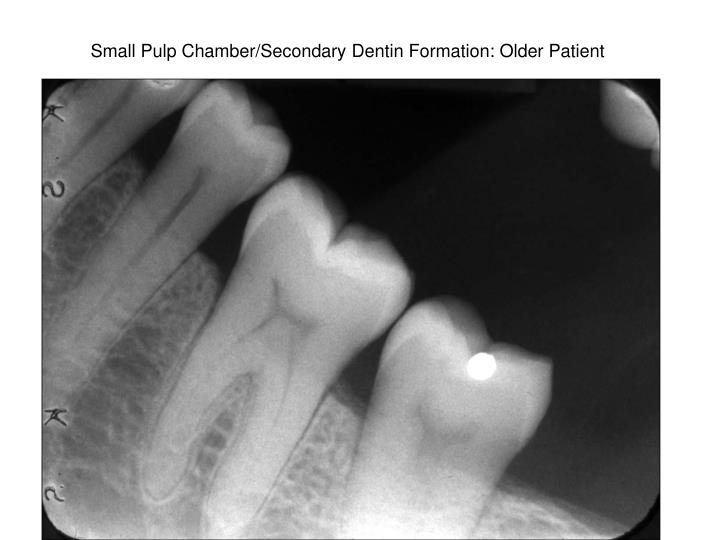 PPT - RADIOGRAPHIC INTERPRETATION OF PULPAL AND PERIAPICAL DISEASE ...
