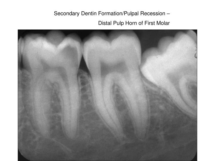 PPT - RADIOGRAPHIC INTERPRETATION OF PULPAL AND PERIAPICAL DISEASE ...