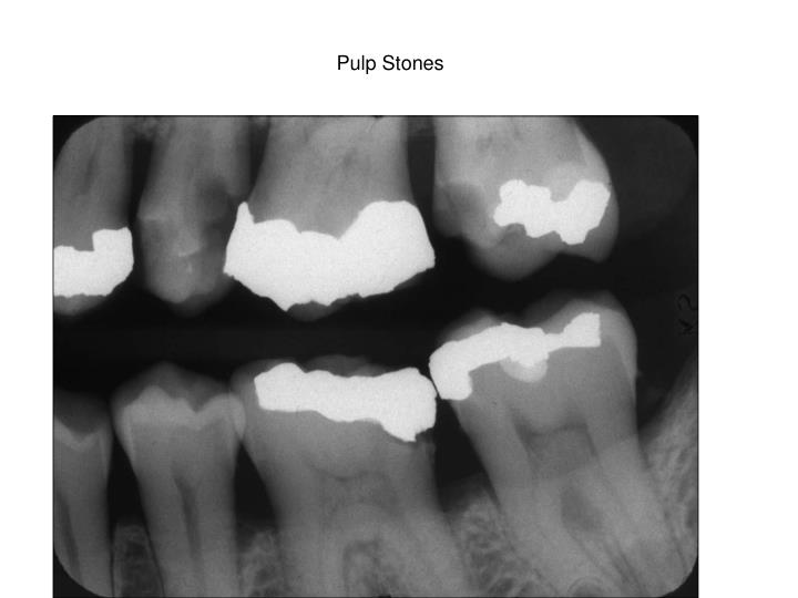 PPT - RADIOGRAPHIC INTERPRETATION OF PULPAL AND PERIAPICAL DISEASE ...
