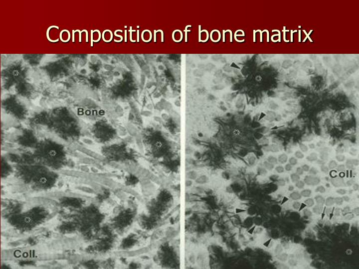 PPT - The SKELETAL SYSTEM PowerPoint Presentation - ID:5455792