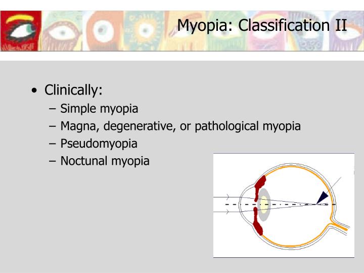 PPT - MYOPIA PowerPoint Presentation - ID:5459221