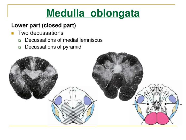 PPT - The brain stem PowerPoint Presentation - ID:5459334