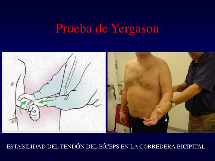 PPT - LUXACIÓN GLENOHUMERAL PowerPoint Presentation - ID:5462778