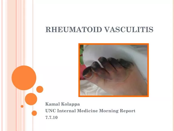 PPT - RHEUMATOID VASCULITIS PowerPoint Presentation, free download - ID ...