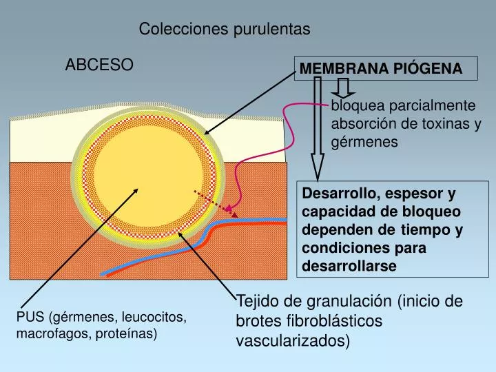 PPT - Colecciones purulentas PowerPoint Presentation, free download ...