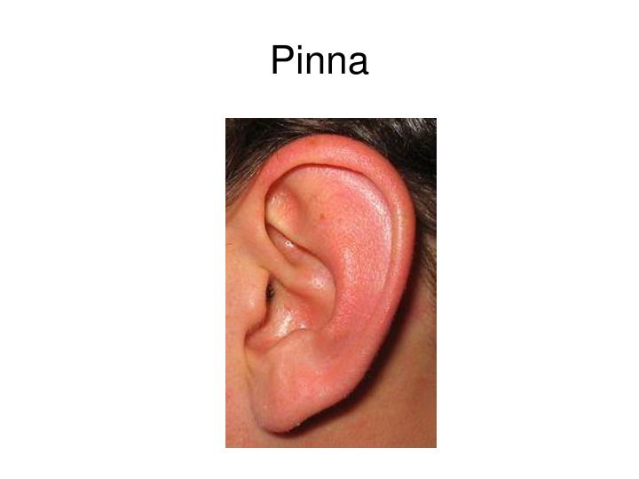 PPT - Pinna PowerPoint Presentation - ID:5465544