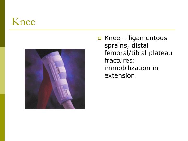 PPT - Splinting Seminar PowerPoint Presentation - ID:5465564