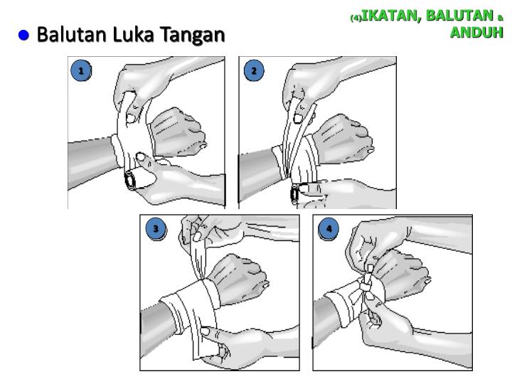 PPT - Pembebatan digunakan untuk menutup luka dan mengawal pendarahan ...