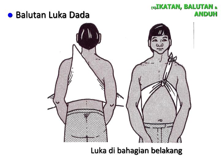 PPT - Pembebatan digunakan untuk menutup luka dan mengawal pendarahan ...