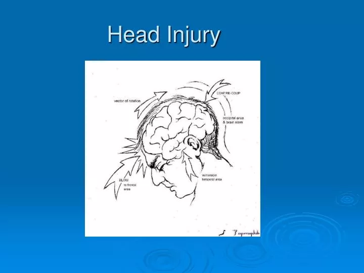 PPT - Head Injury PowerPoint Presentation, free download - ID:5473382