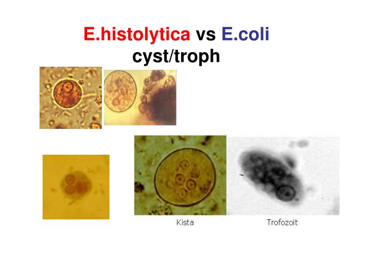 What Is The Difference Between Entamoeba Histolytica - vrogue.co What Is The Difference Between Entamoeba Histolytica - vrogue.co