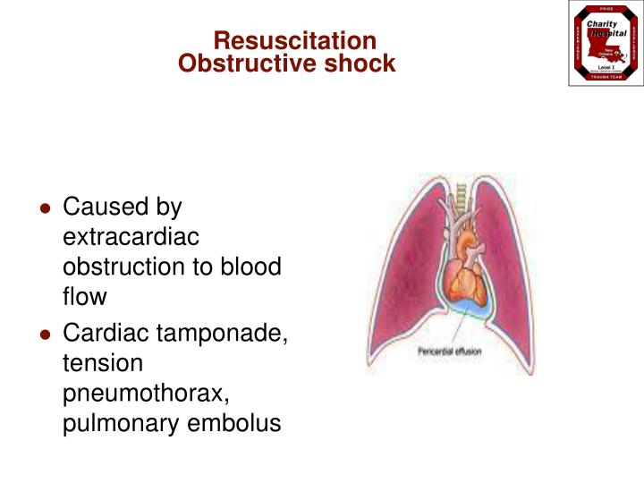 PPT - Resuscitation and Shock PowerPoint Presentation - ID:5486696
