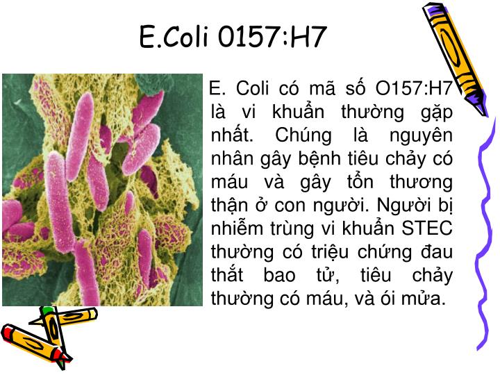PPT - Vi Khuẩn E.Coli PowerPoint Presentation - ID:5496531