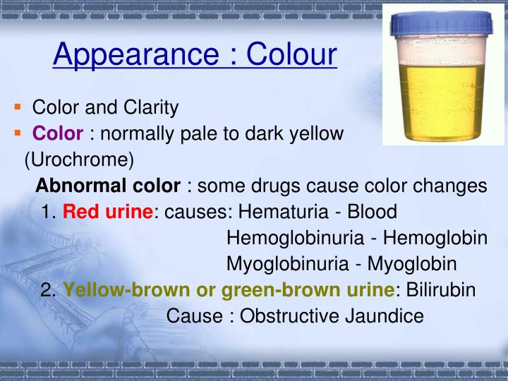 PPT - Urinalysis PowerPoint Presentation - ID:5498707