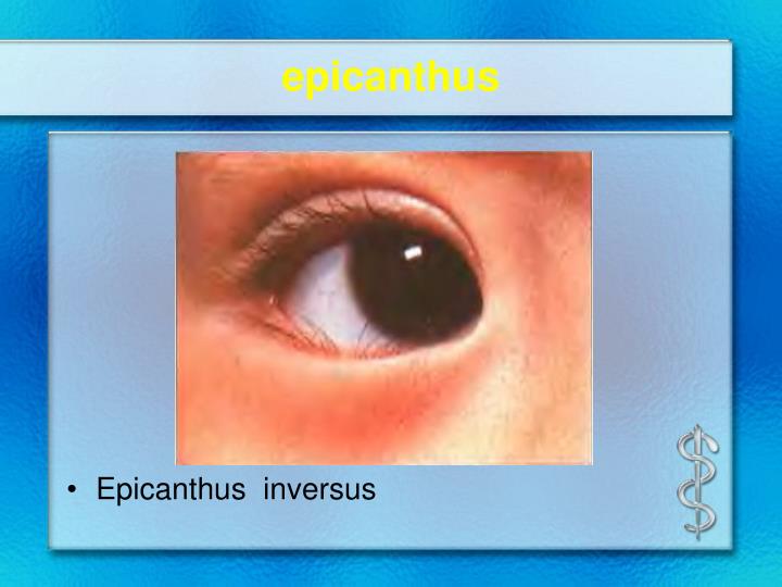 PPT - Lids Disease PowerPoint Presentation - ID:5500339