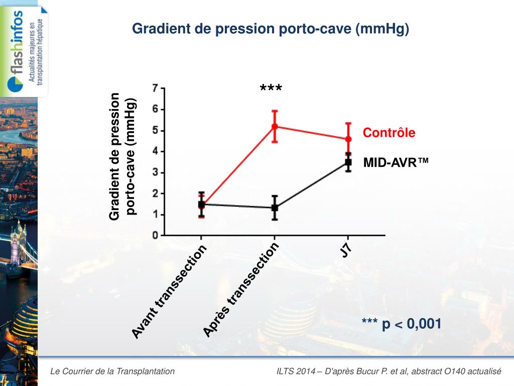 PPT - Valeur de la pression portale au décours d’une hépatectomie ...