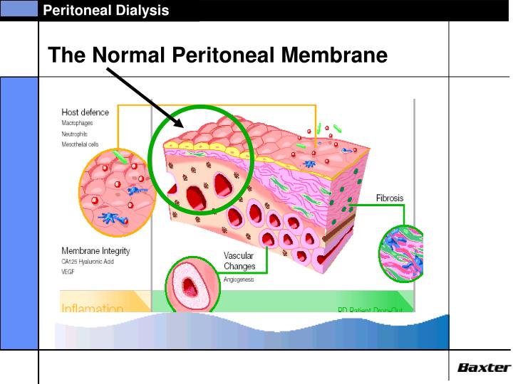 PPT - Anatomy and Physiology of Peritoneal Dialysis PowerPoint ...
