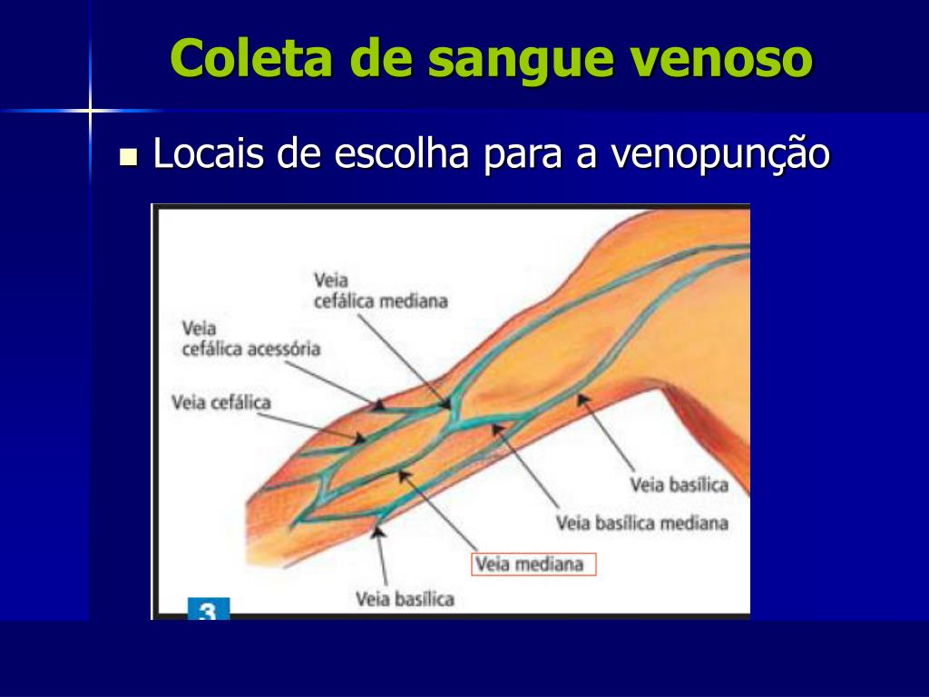 Locais Para Punção Venosa - LIBRAIN Locais Para Punção Venosa - LIBRAIN