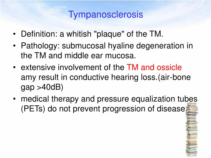PPT - Otosclerosis PowerPoint Presentation - ID:5505894
