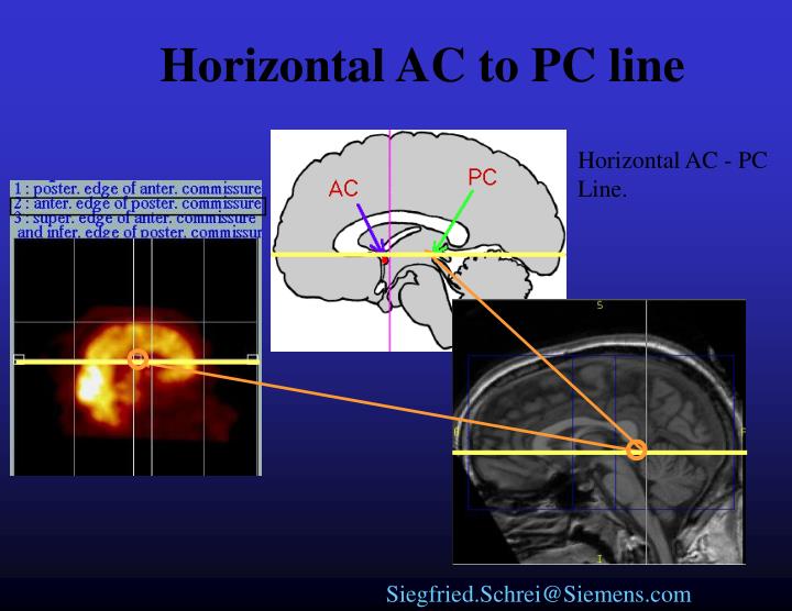 PPT - Siegfried Schrei Siemens MI Applications PowerPoint Presentation ...