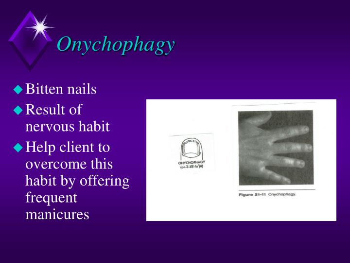 PPT - Nail Diseases PowerPoint Presentation - ID:5509362