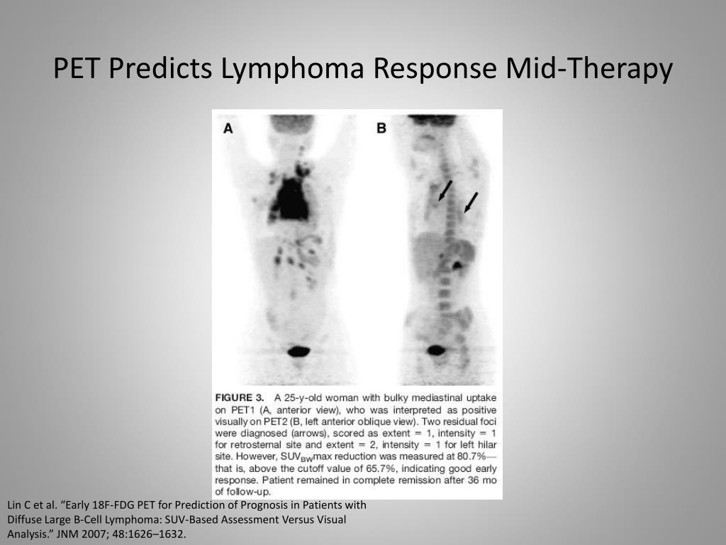 PPT - Role of FDG PET(/CT) in Assessing Response to Treatment of ...