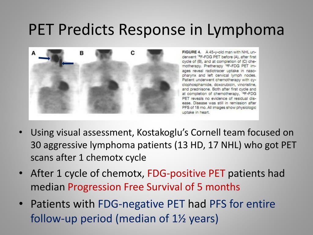 PPT - Role of FDG PET(/CT) in Assessing Response to Treatment of ...