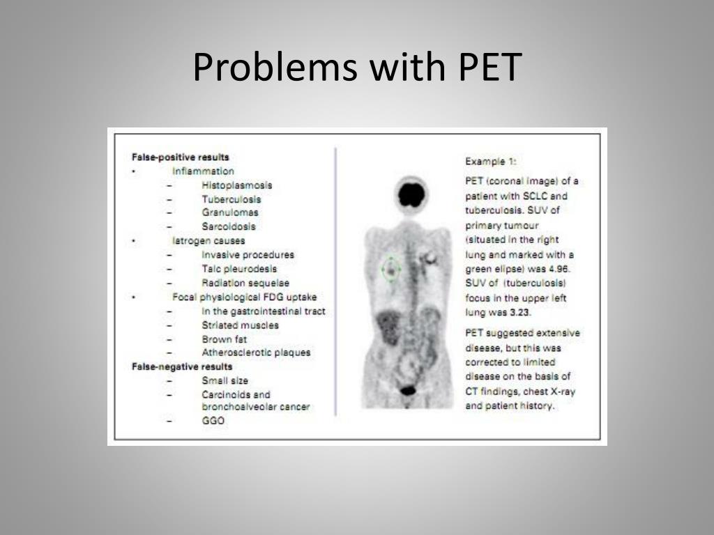 PPT - Role of FDG PET(/CT) in Assessing Response to Treatment of ...