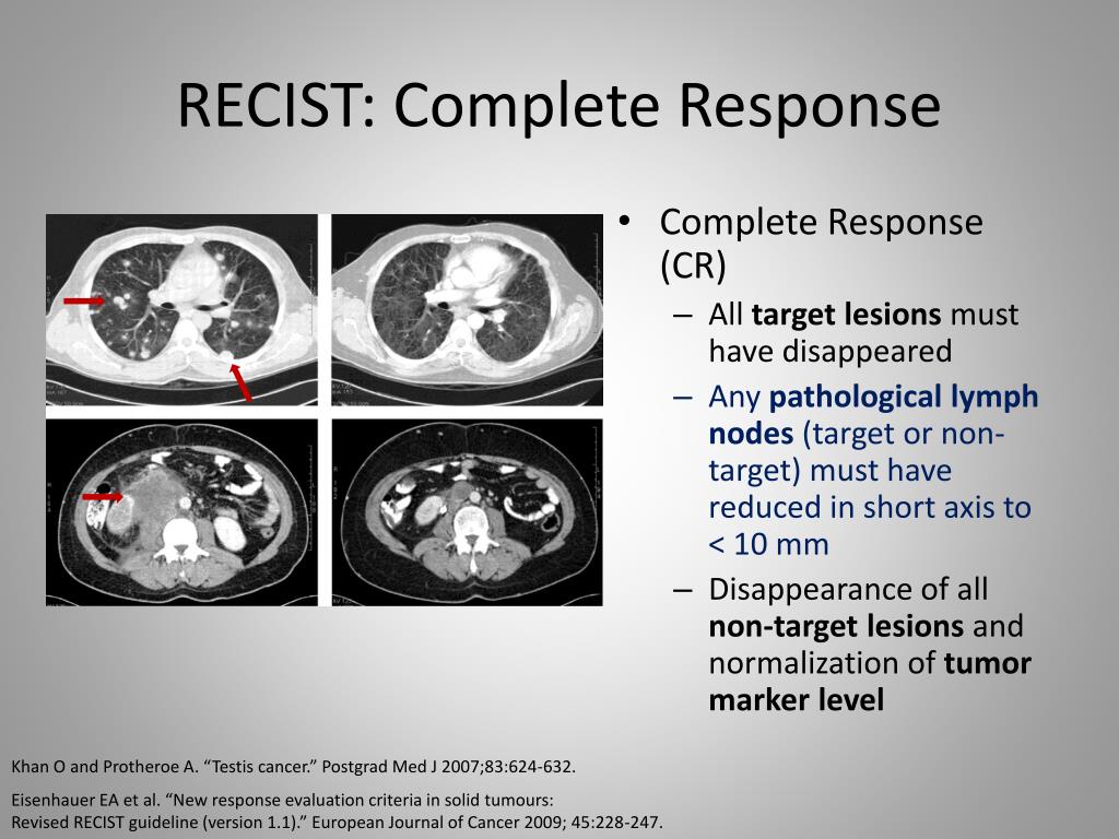 PPT - Role of FDG PET(/CT) in Assessing Response to Treatment of ...
