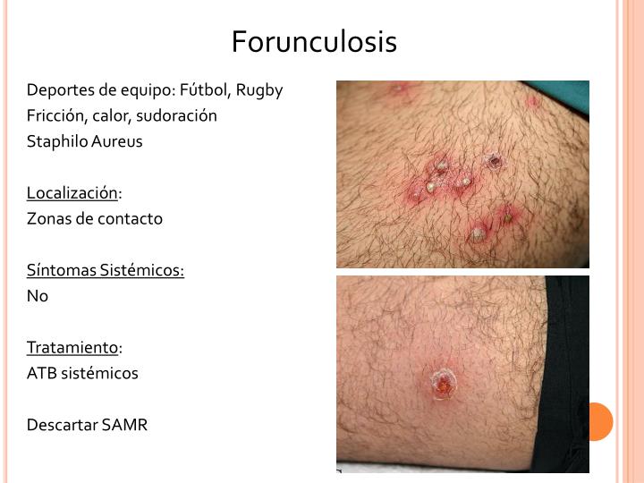 PPT - Dermatología y el Deporte PowerPoint Presentation - ID:5514251