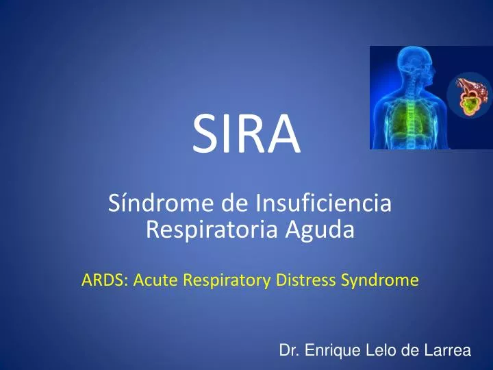 PPT - SIRA PowerPoint Presentation, free download - ID:5518068