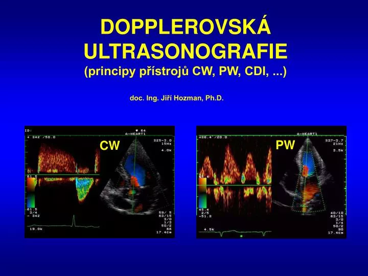 PPT - DOPPLEROVSKÁ ULTRASONOGRAFIE (principy přístrojů CW, PW, CDI ...