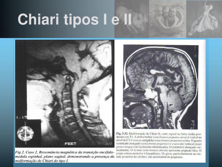 PPT - CASO CLÍNICO PowerPoint Presentation - ID:5518965
