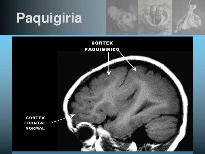 PPT - CASO CLÍNICO PowerPoint Presentation - ID:5518965