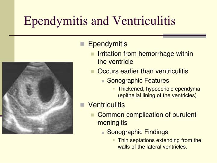 PPT - Neonatal Echoencephalography PowerPoint Presentation - ID:5519290