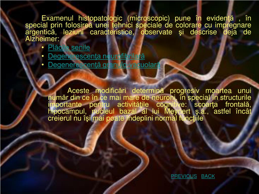 PPT - Boala Alzheimer PowerPoint Presentation, free download - ID:5523577 PPT - Boala Alzheimer PowerPoint Presentation, free download - ID:5523577