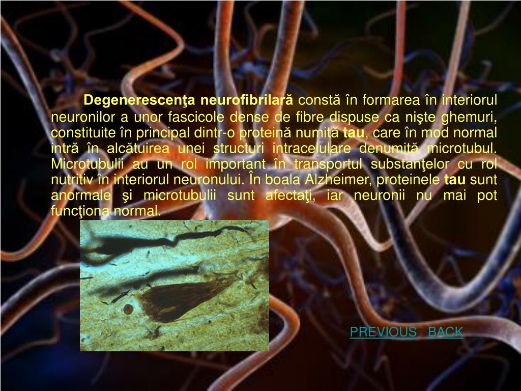 PPT - Boala Alzheimer PowerPoint Presentation, free download - ID:5523577 PPT - Boala Alzheimer PowerPoint Presentation, free download - ID:5523577