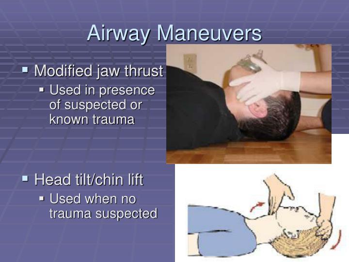PPT - Trauma Morbidity and Mortality PowerPoint Presentation - ID:5526361