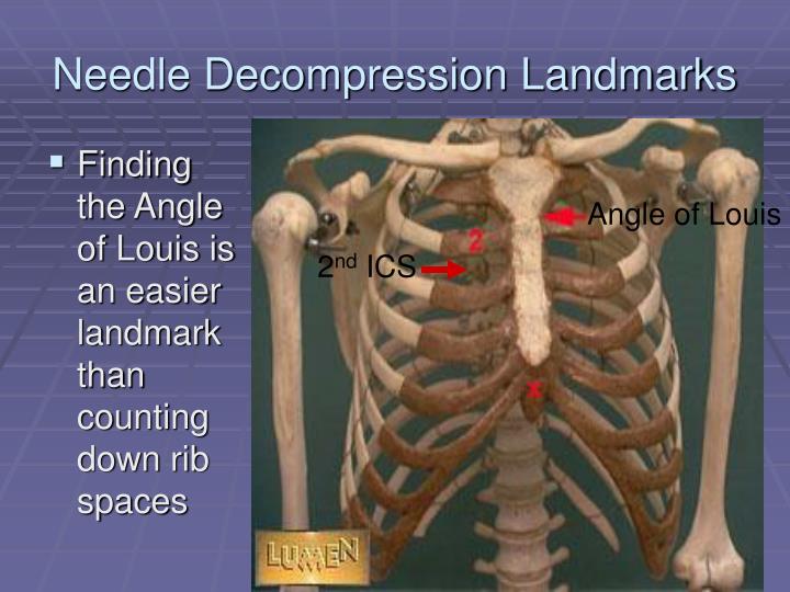 PPT - Trauma Morbidity and Mortality PowerPoint Presentation - ID:5526361