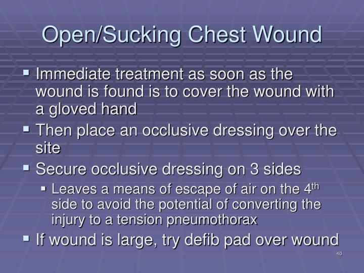 PPT - Trauma Morbidity and Mortality PowerPoint Presentation - ID:5526361