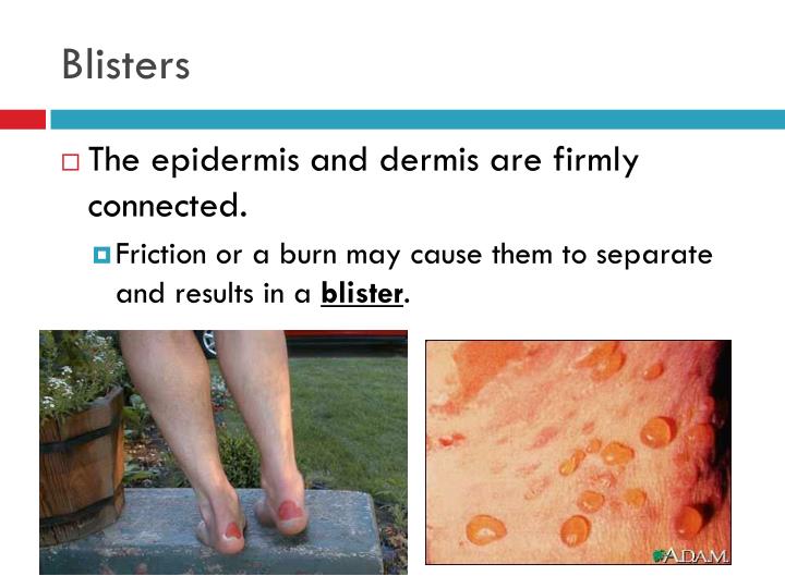 PPT - Skin and Body Membranes – Part 1 PowerPoint Presentation - ID:5527304