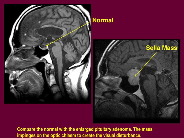 PPT - M-1 RADIOLOGY Head and Neck PowerPoint Presentation - ID:5537403