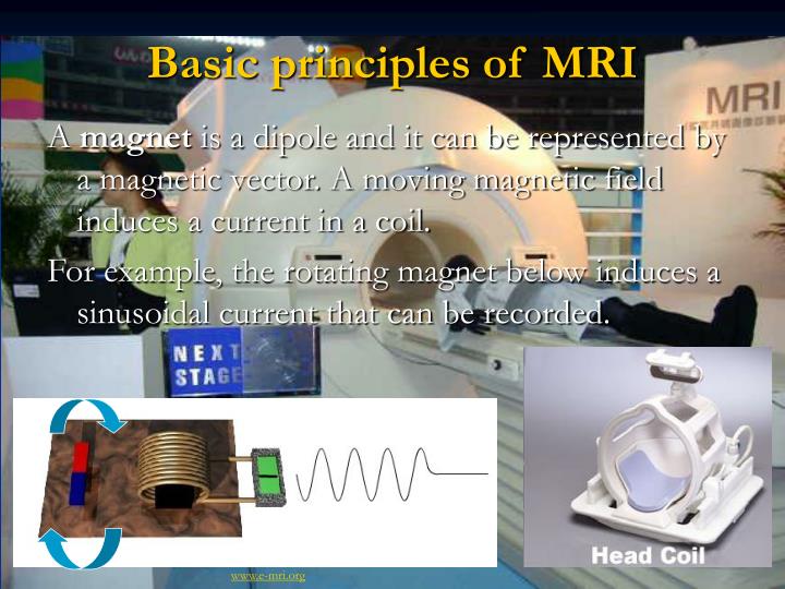 PPT - Volumetric Analysis of Brain Structures Using MR Imaging ...