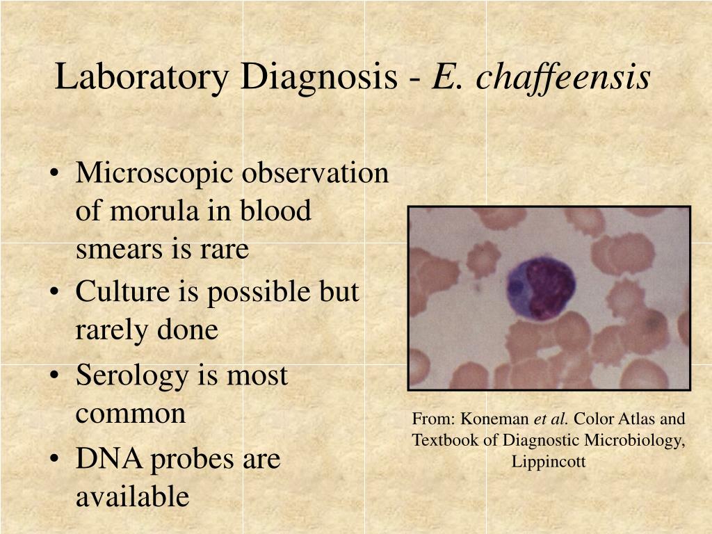 PPT - Rickettsia, Orientia, Ehrlichia, Anaplasma, Coxiella and ...