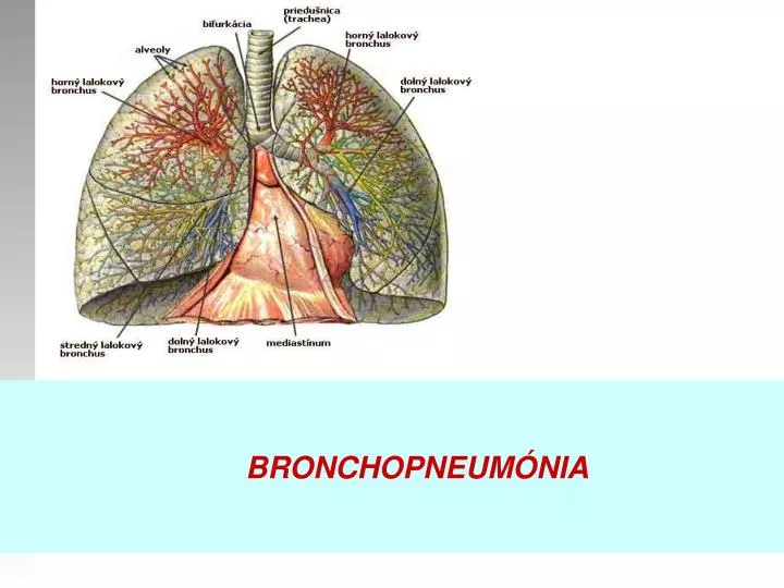 PPT - BRONCHOPNEUMÓNIA PowerPoint Presentation, free download - ID:5551325