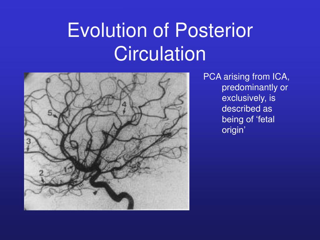 PPT - Cerebrovascular Embryology October 6, 2000 PowerPoint ...
