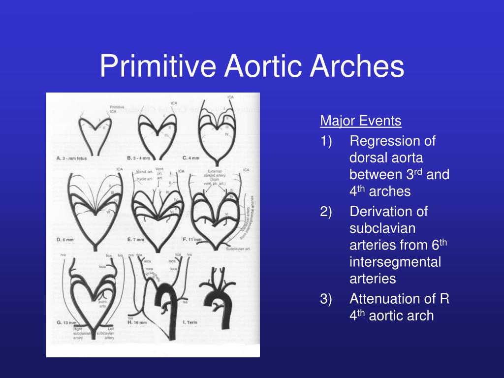 PPT - Cerebrovascular Embryology October 6, 2000 PowerPoint ...