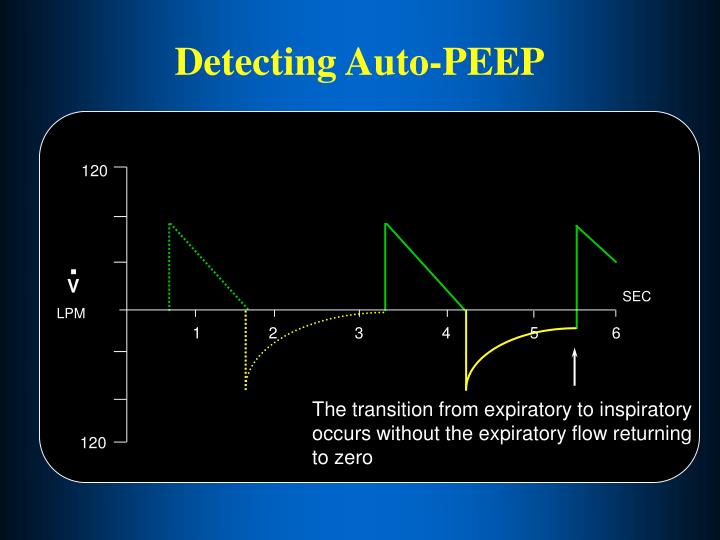 PPT - BASICS OF WAVEFORM INTERPRETATION Michael Haines, MPH, RRT-NPS ...