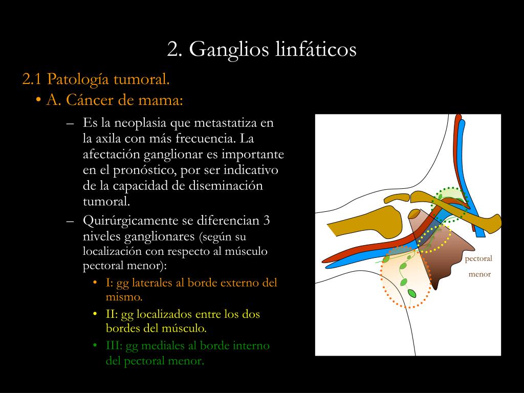 PPT - Estudio de la axila en una sección de mama PowerPoint ...